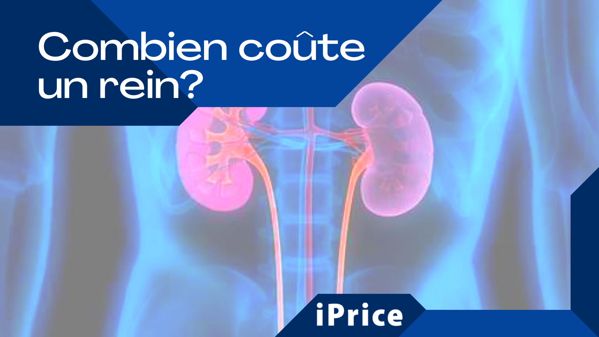 Combien coûte un rein : la valeur du corps humain sur le marché noir et ...